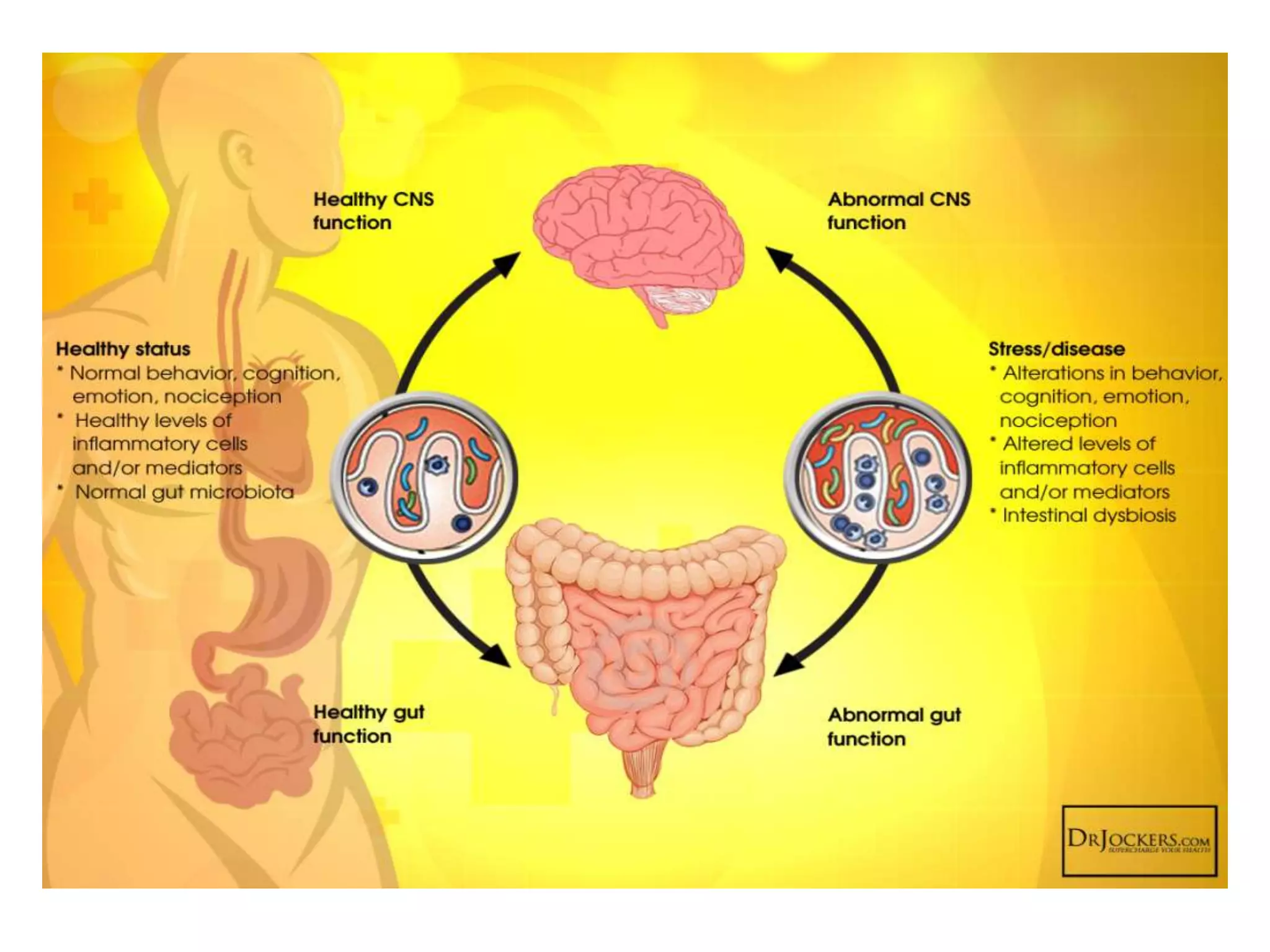 Small intestinal bacterial overgrowth (SIBO) | PPTX