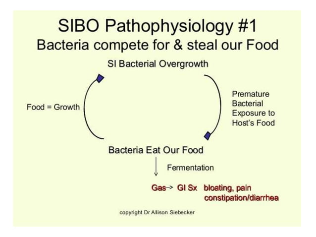 Small intestinal bacterial overgrowth (SIBO) | PPTX