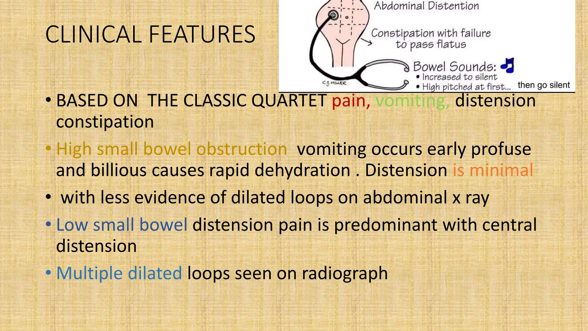SMALL INTESTINAL OBSTRUCTION.pptx