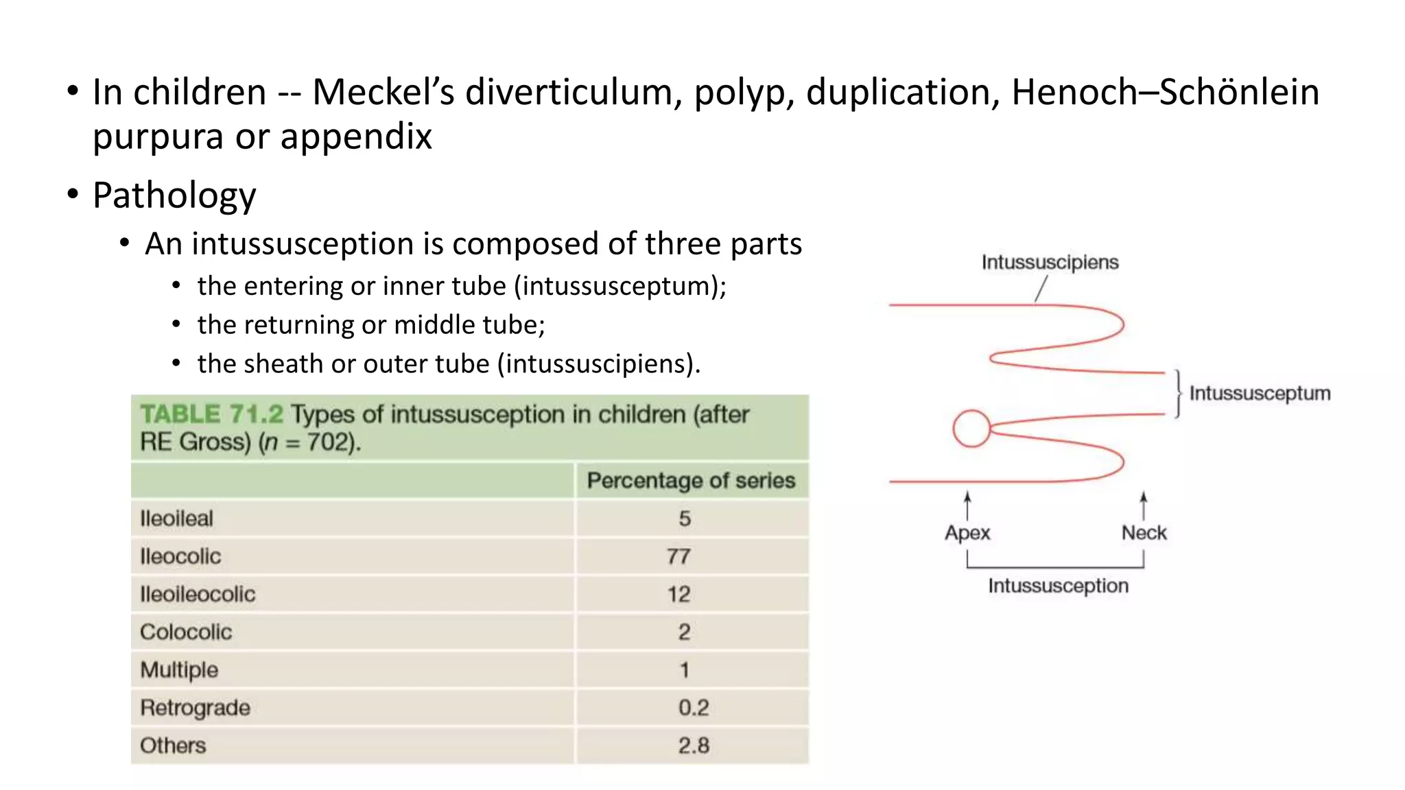 Small intestine/Intestinal obstruction/crohns disease/ileostomy/viscous ...