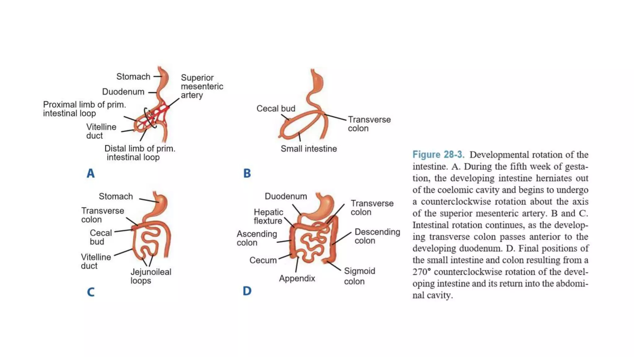 Small intestine/Intestinal obstruction/crohns disease/ileostomy/viscous ...