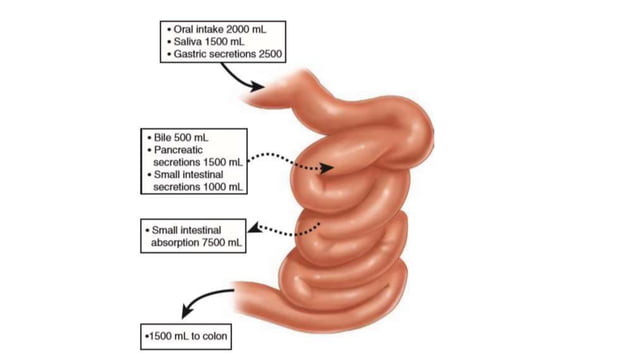 Small intestine/Intestinal obstruction/crohns disease/ileostomy/viscous ...