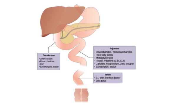 Small intestine/Intestinal obstruction/crohns disease/ileostomy/viscous ...
