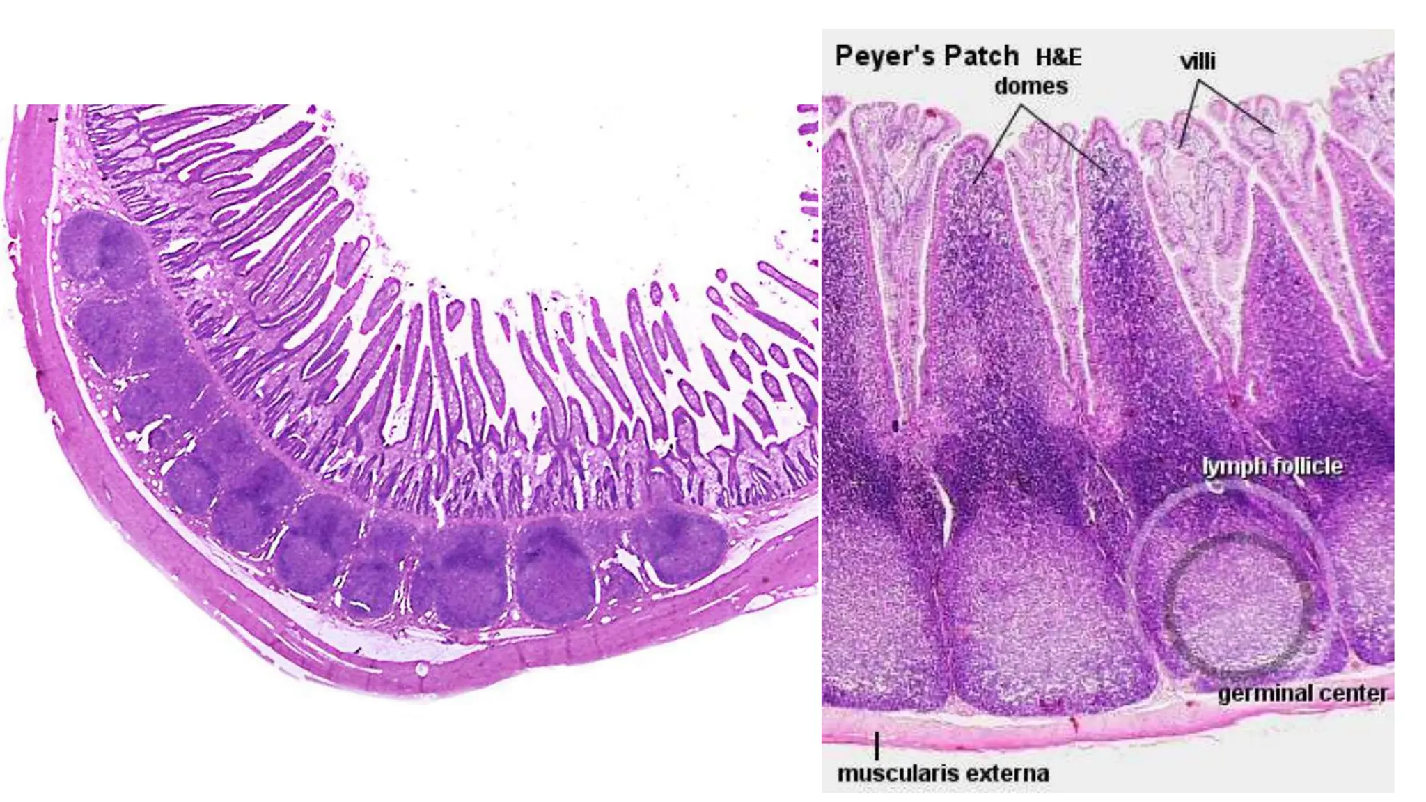 Small Intestine.pptx