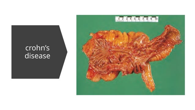 small intestine anatomy , function pathology.pptx