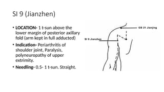 Small Intestine, introduction, indications, pathway.pptx