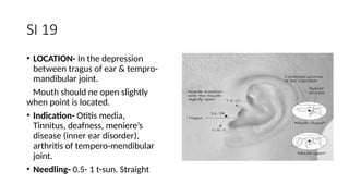 Small Intestine, introduction, indications, pathway.pptx