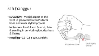 Small Intestine, introduction, indications, pathway.pptx