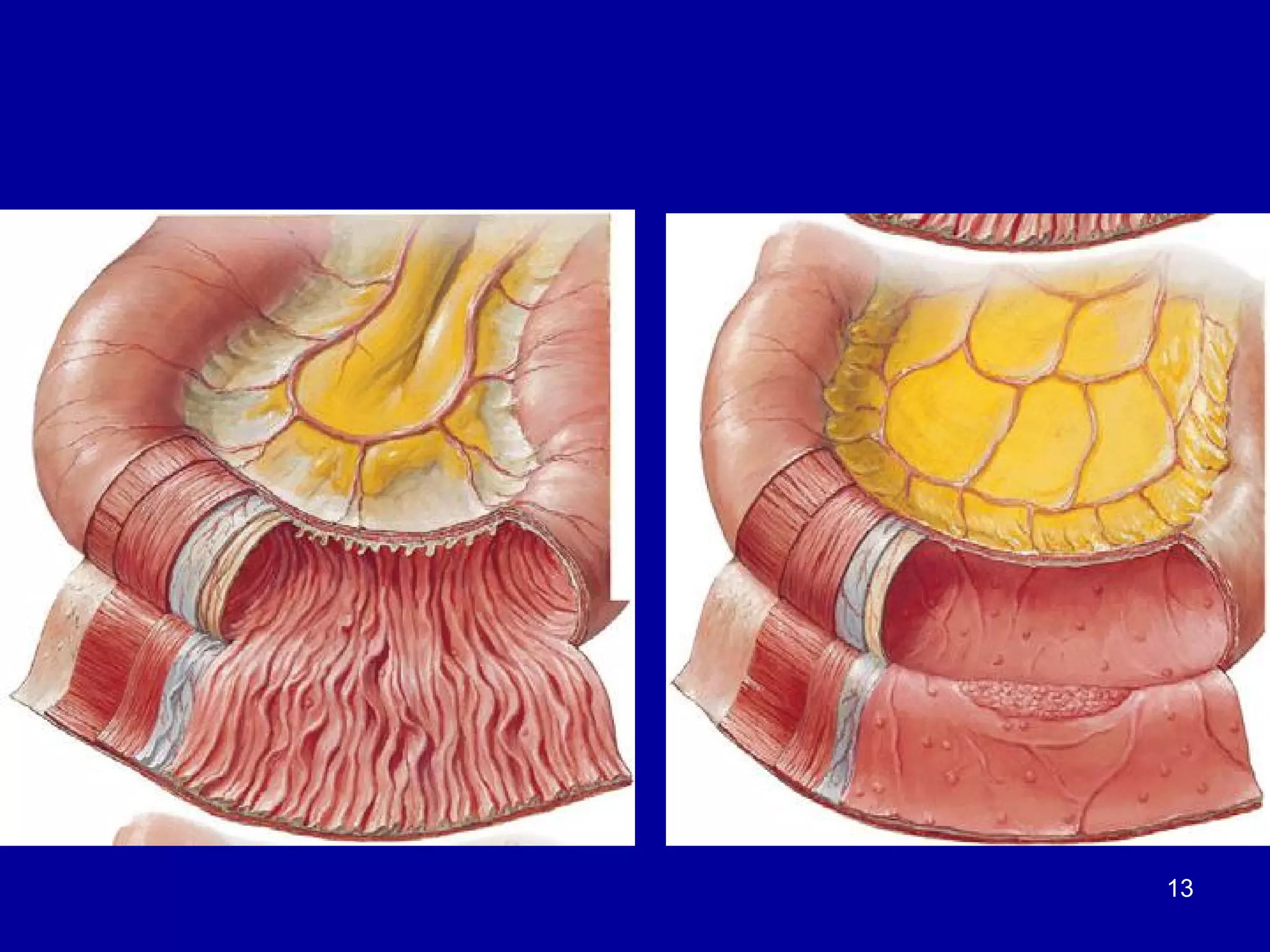 radiological anatomy of Small intestine abdul final | PDF