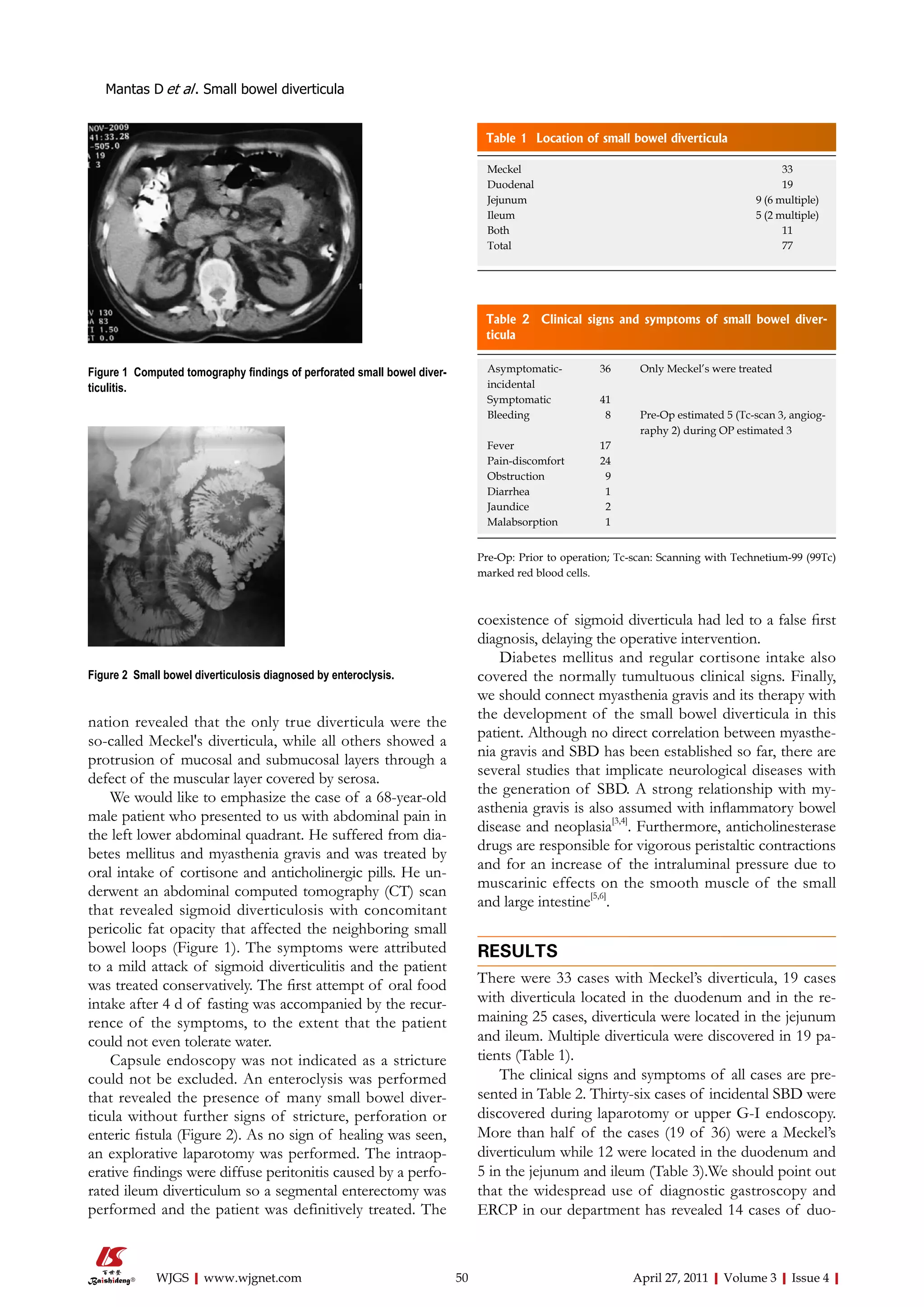 SMALL INTESTINE DIVERTICULA.pdf
