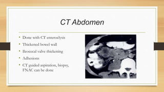 Small Intestine TB (Tuberculosis) | PPTX
