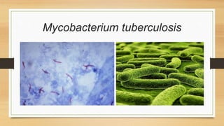 Small Intestine TB (Tuberculosis) | PPTX