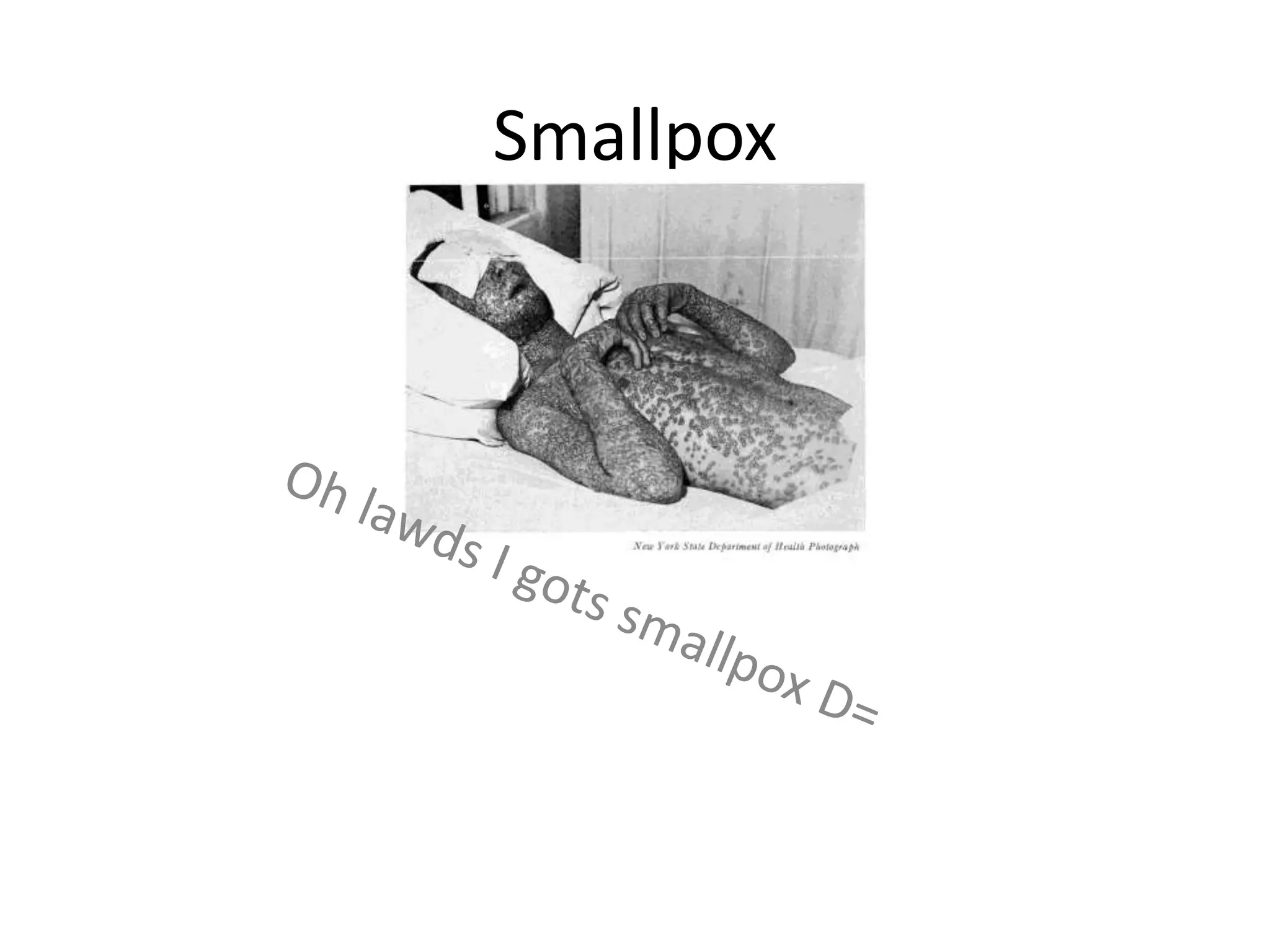 Smallpox | PPTX
