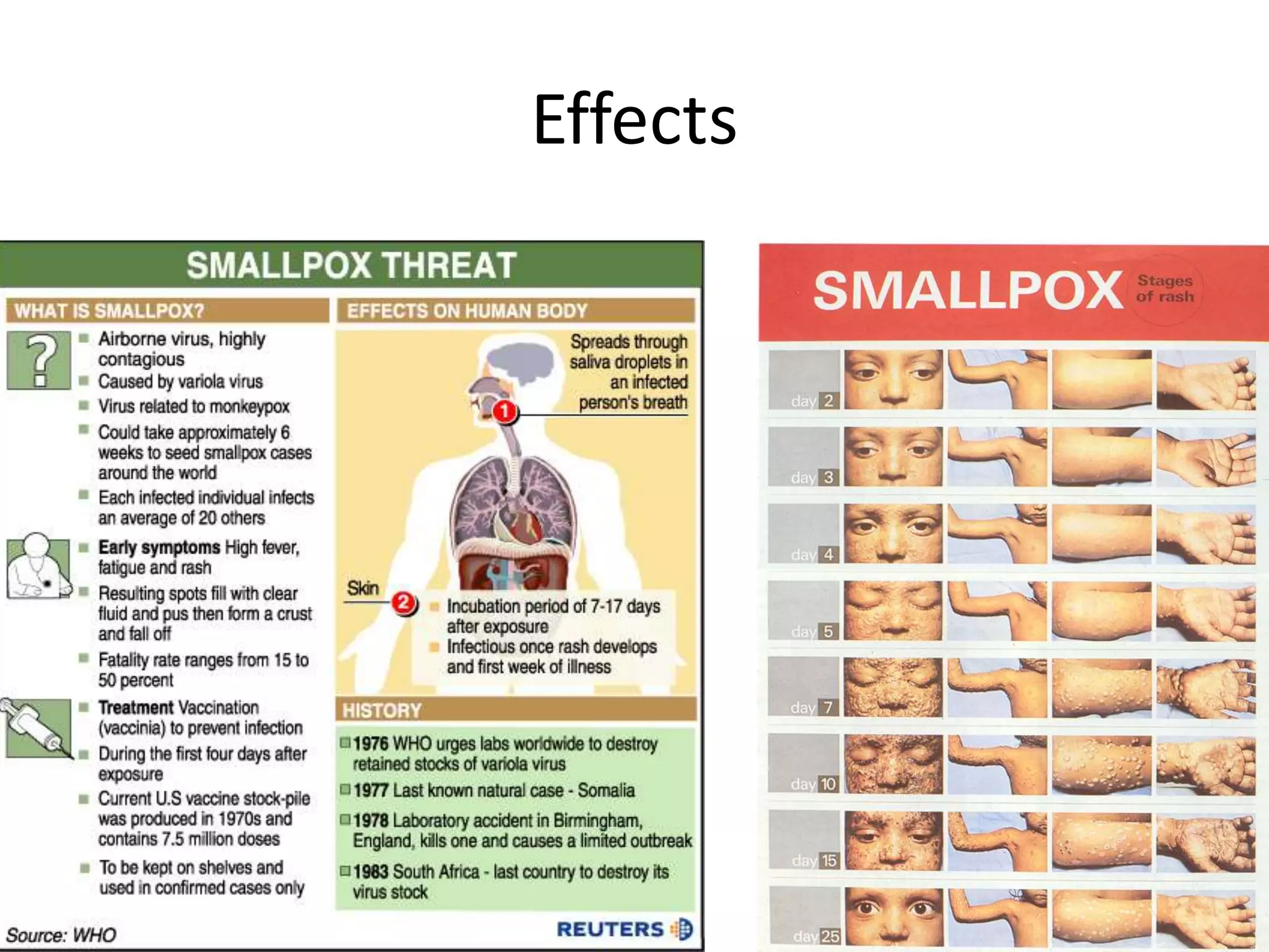 Smallpox | PPT