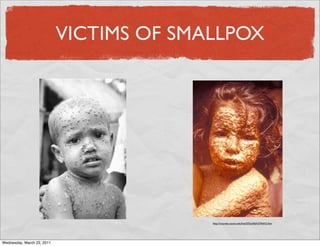 Smallpox | PPT