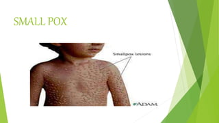 Small pox.pptx