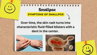 SMALLPOX Symptoms and treatment ppt pdf | PPT