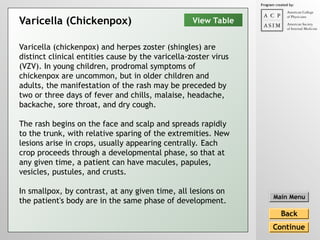 smallpox.ppt Smallpox ppt smallpox ppt small pox | PPT