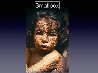 Smallpox | PPT
