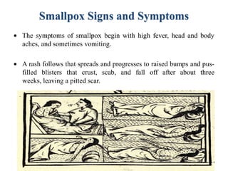 Smallpox disease | PPT