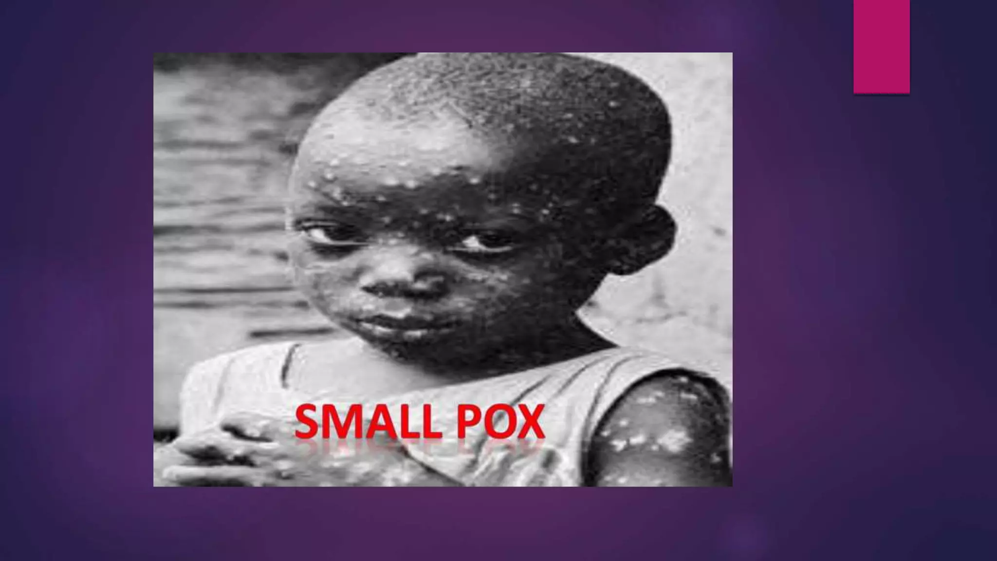 SMALL POX; Variola virus@variola major and variola minor.pptx | Free ...