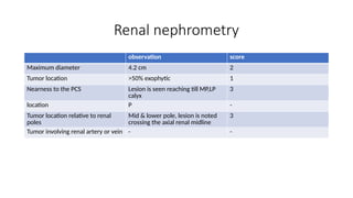 presentation on small renal masses small renal mass.pptx