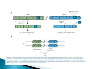 Sma ppt | PPTX