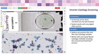 Using Artificial Intelligence For Cytology Screening | PPTX
