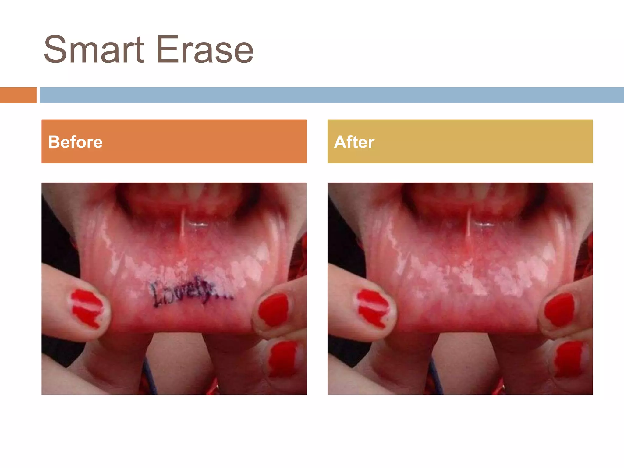Smart erase | PPTX