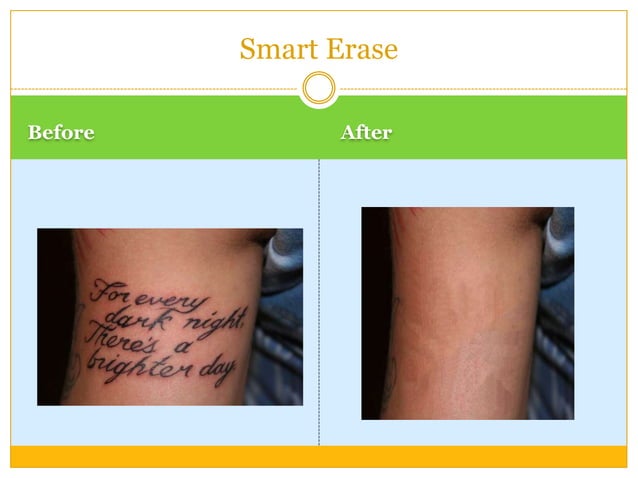 Smart erase & red eye project | PPTX