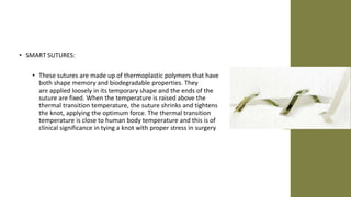 SMART MATERIALS AT DENT.pptx