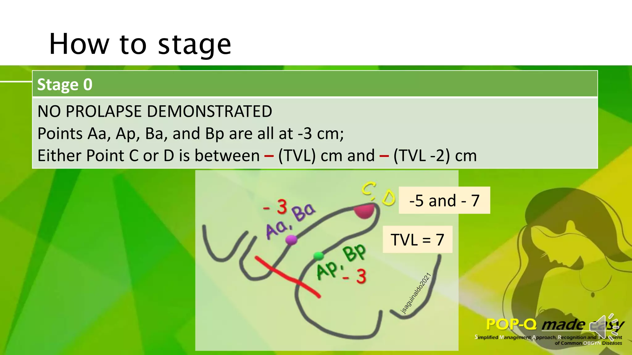 POP-Q made easy | PPSX