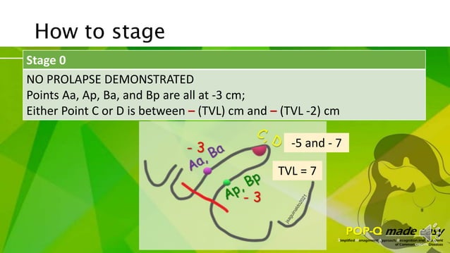 POP-Q made easy | PPSX | Reproductive Health | Diseases and Conditions
