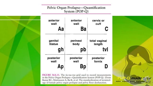 POP-Q made easy | PPSX | Reproductive Health | Diseases and Conditions