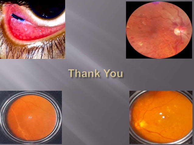 Smartphone ophthalmic imaging | PPT