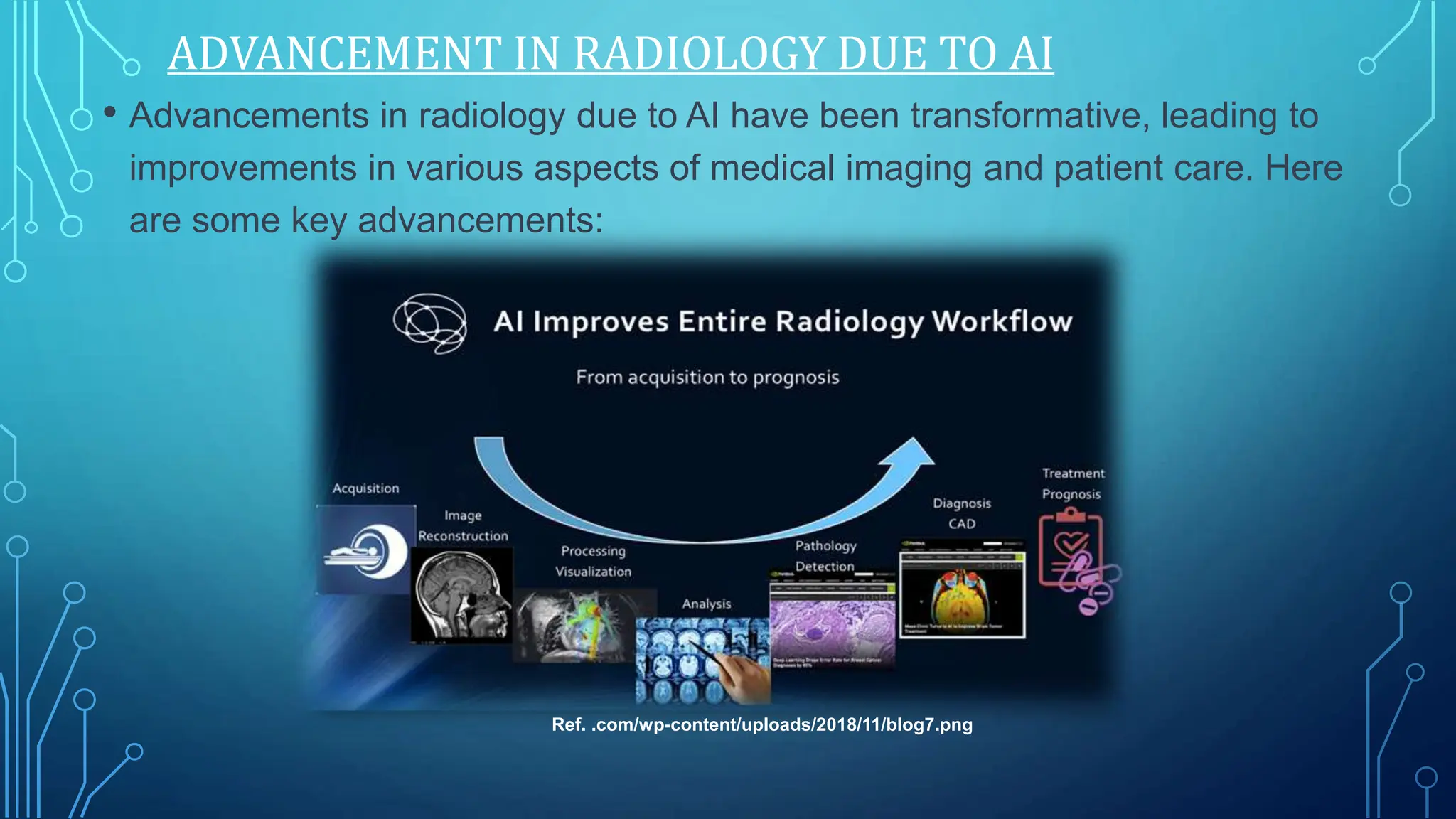 SMART RADIOLOGY : AI INNOVATIONS | PPTX