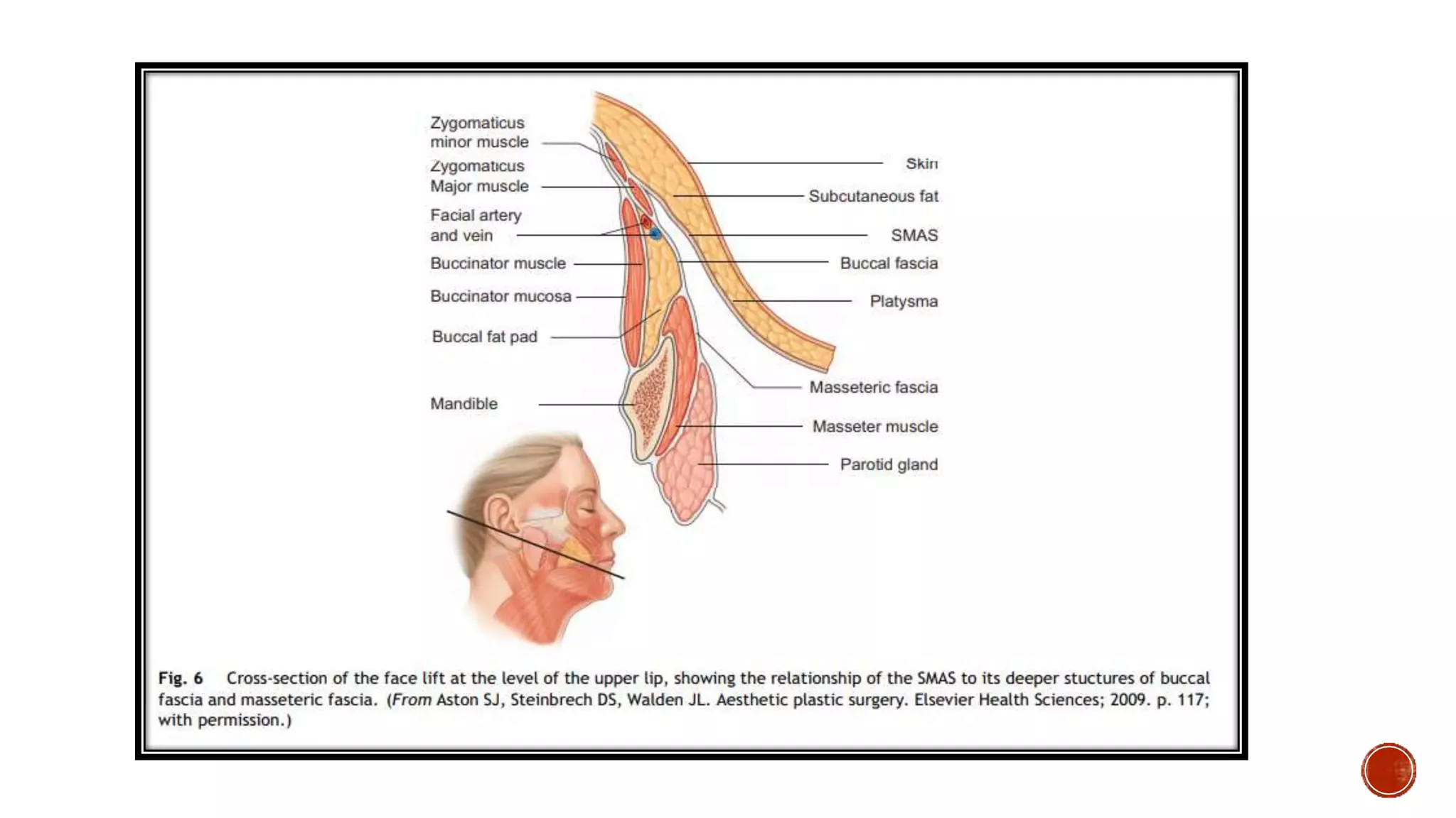 Superficial Musculo Aponeurotic System(SMAS) | PPTX