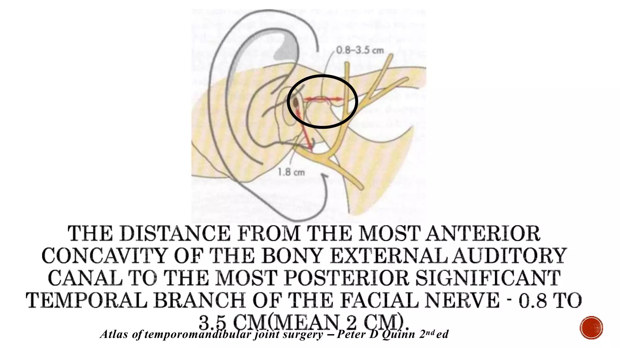 Superficial Musculo Aponeurotic System(SMAS) | PPTX