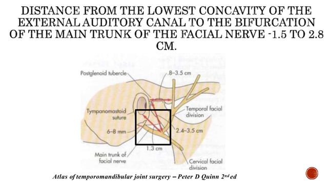 Superficial Musculo Aponeurotic System(SMAS) | PPTX | Death, Injury, or ...