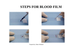 Smear blood 2.pptx