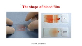 Smear blood 2.pptx