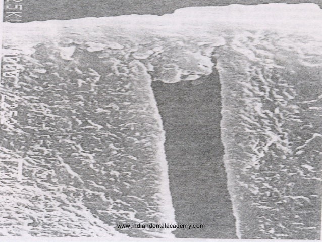 Smear layer / dental courses