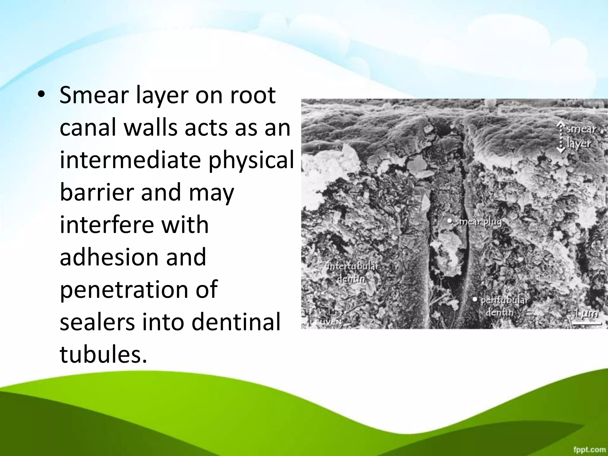 The Smear layer in endodontics | PPTX