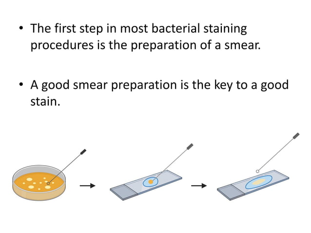 Bacterial Smear preparation