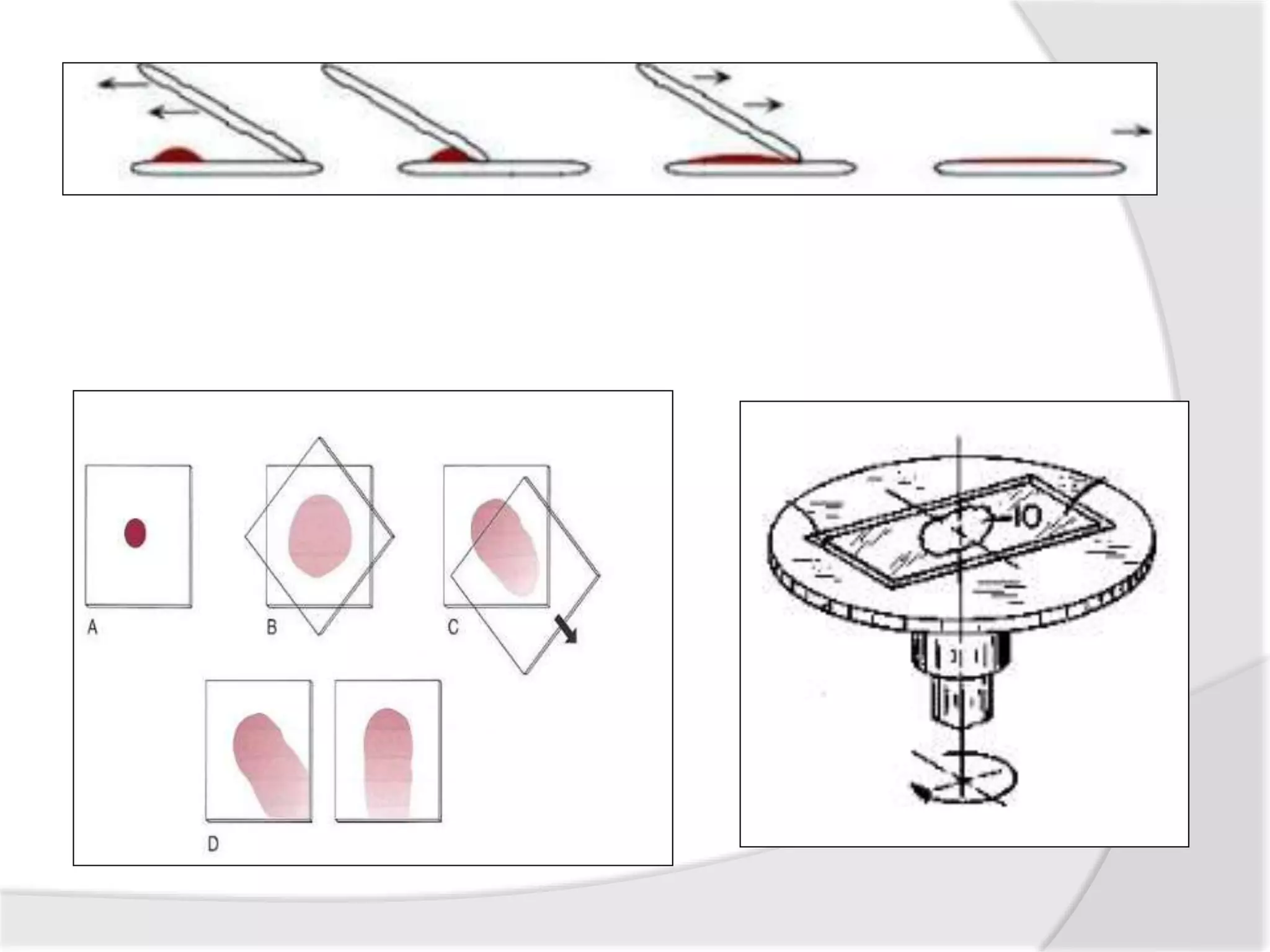Smear preparation for differential leucocyte count | PPTX