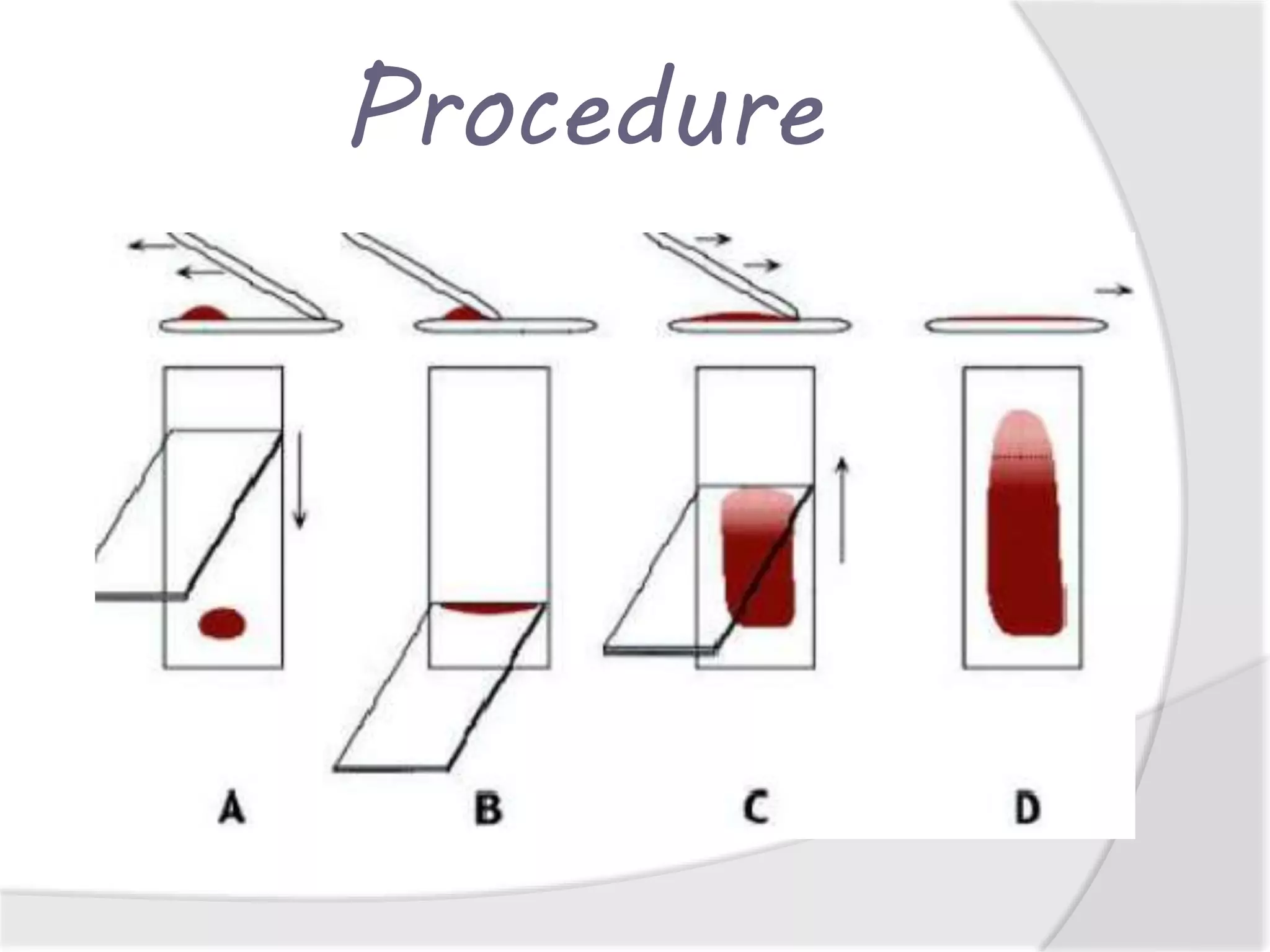 Smear preparation for differential leucocyte count | PPTX