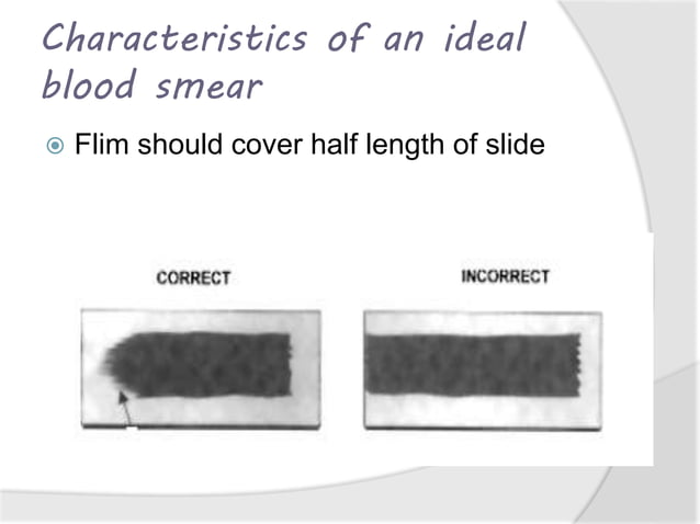 Smear preparation for differential leucocyte count | PPT
