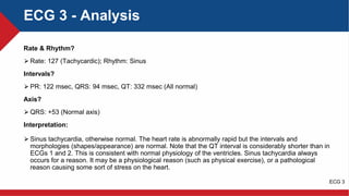 SMG - Cardiac ECG Cases 1-2 - answers.pdf