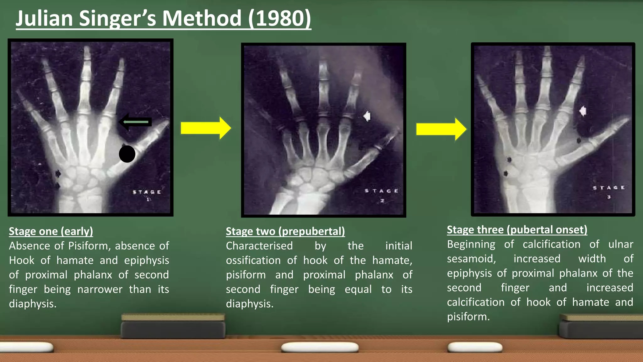 Skeletal Age Assessment and Maturity Indicators | PPTX