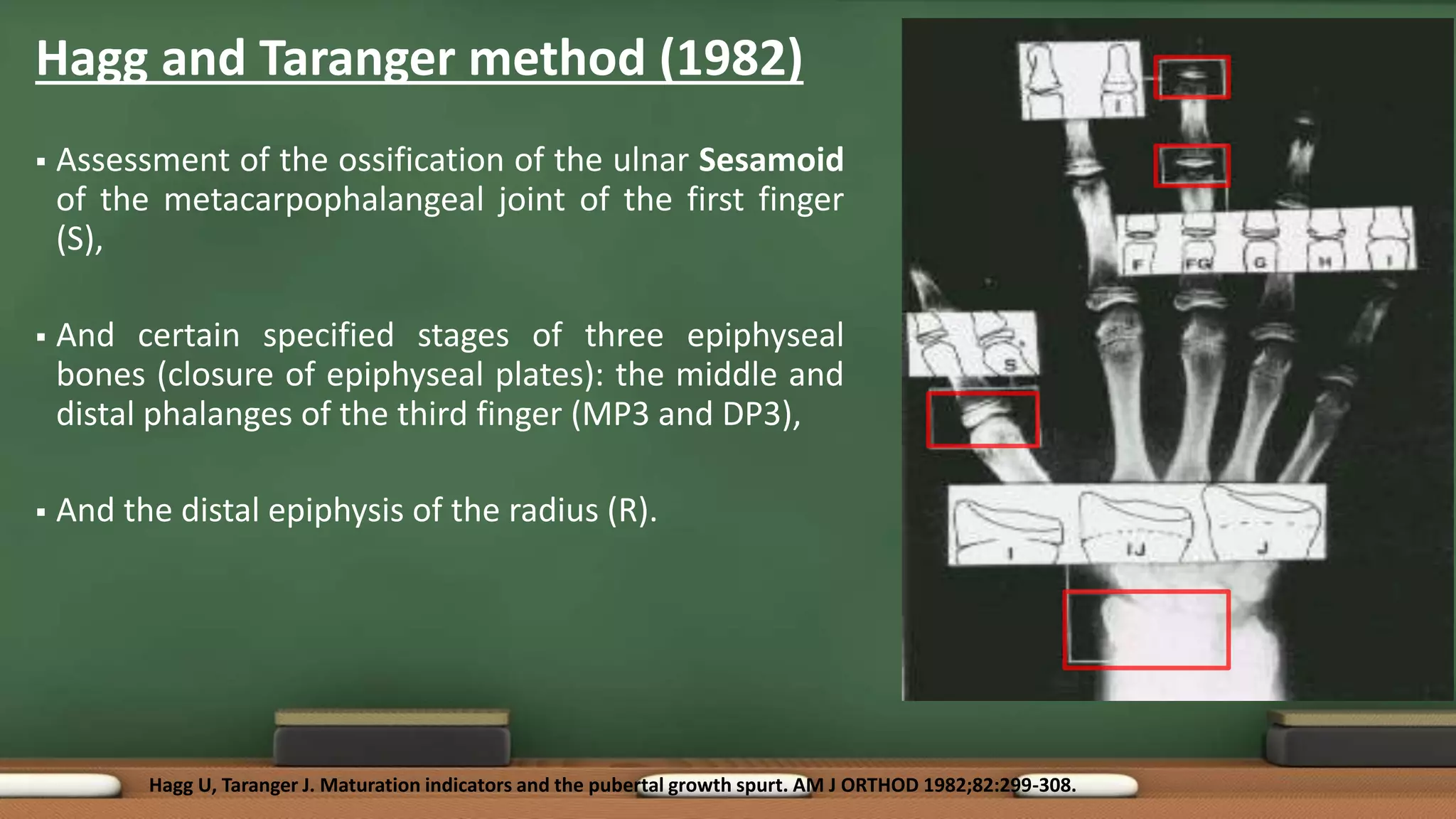 Skeletal Age Assessment and Maturity Indicators | PPTX